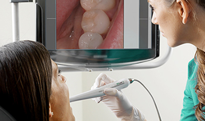 Intraoral Camera - SMILE+ DENTAL STUDIO