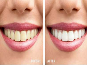 GALLERY - SMILE+ DENTAL STUDIO